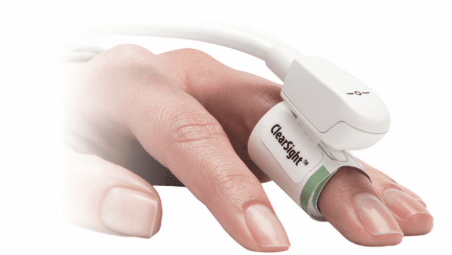 Non Invasive Hemodynamic Monitoring System Market Booming Worldwide ...